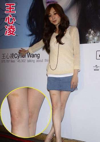为什么这些女明星膝盖淤青 是地板太硬还是用力过猛 凤凰新闻